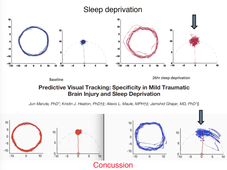 SyncThink unveils latest version of EYE-SYNC | The Stanford Daily